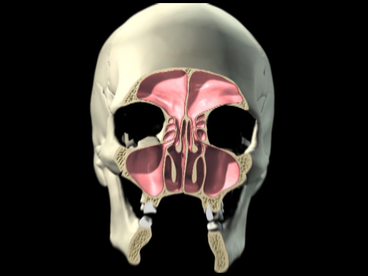 Medical Animation from Visual Health Solutions
