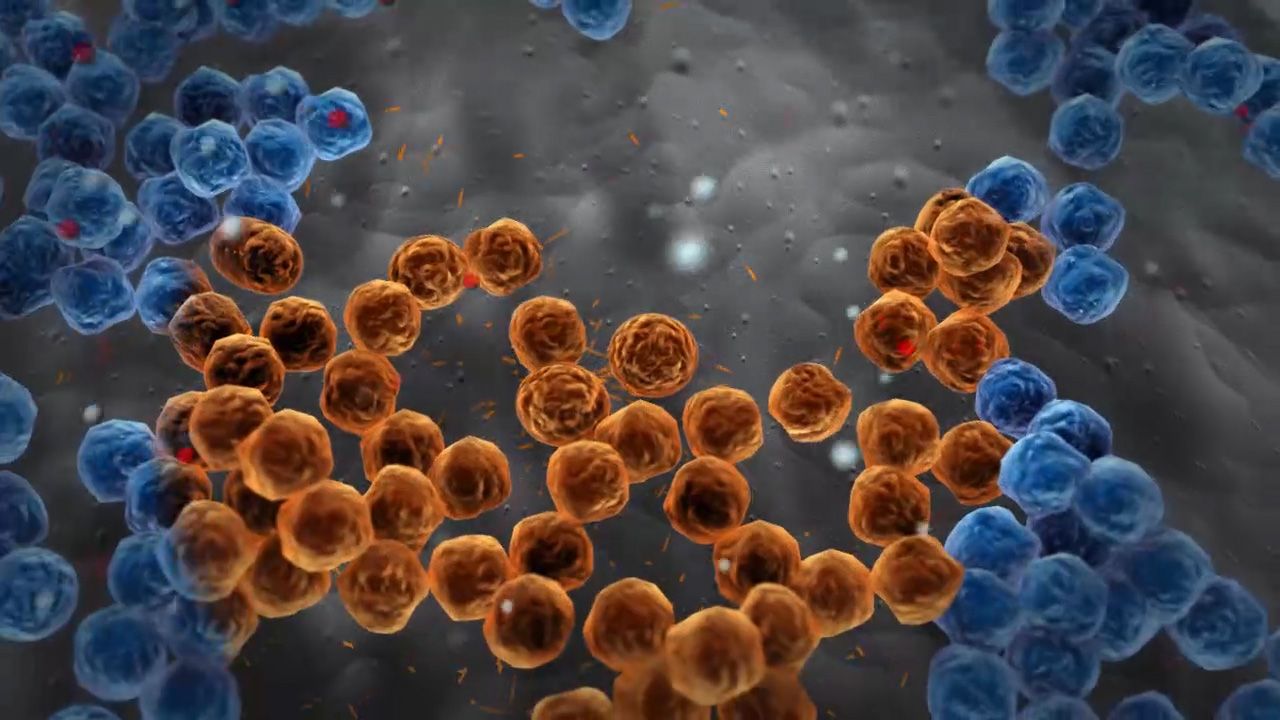 Medical Animation from Visual Health Solutions