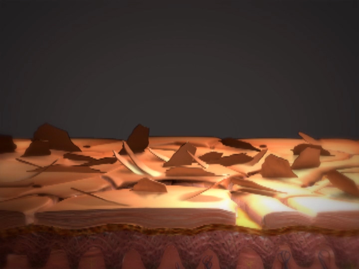 Medical Animation from Visual Health Solutions